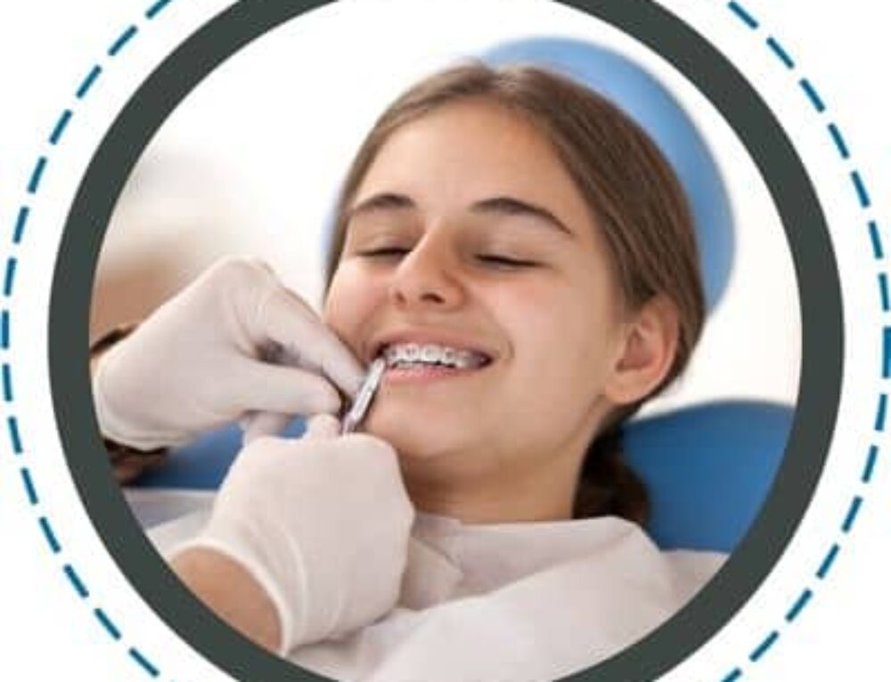 5 Myths About Adult Orthodontics Busted! - Clemente Orthodontics